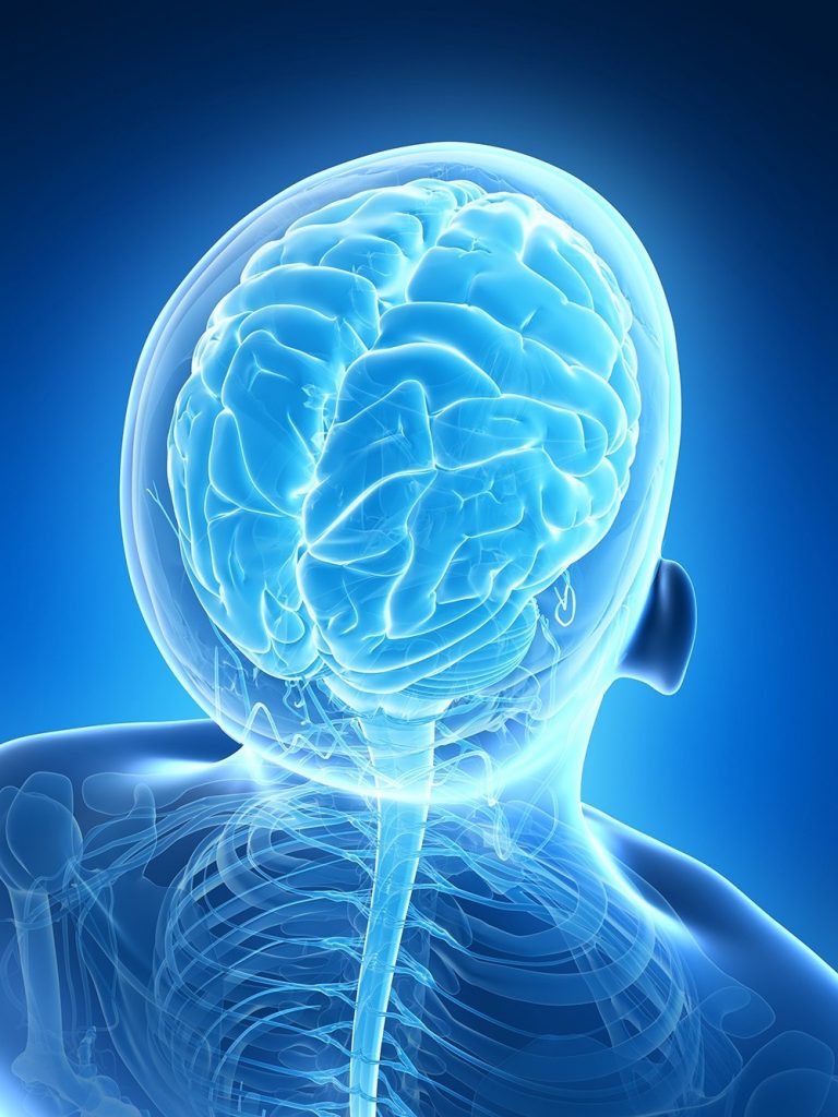 Subdural Hematoma SDH | Subacute SDH | NSPC Brain & Spine Surgery